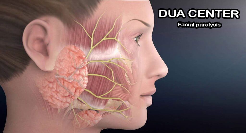 Dua to cure facial paralysis Wazifa Muh ka laqwa ka rohani ilaj